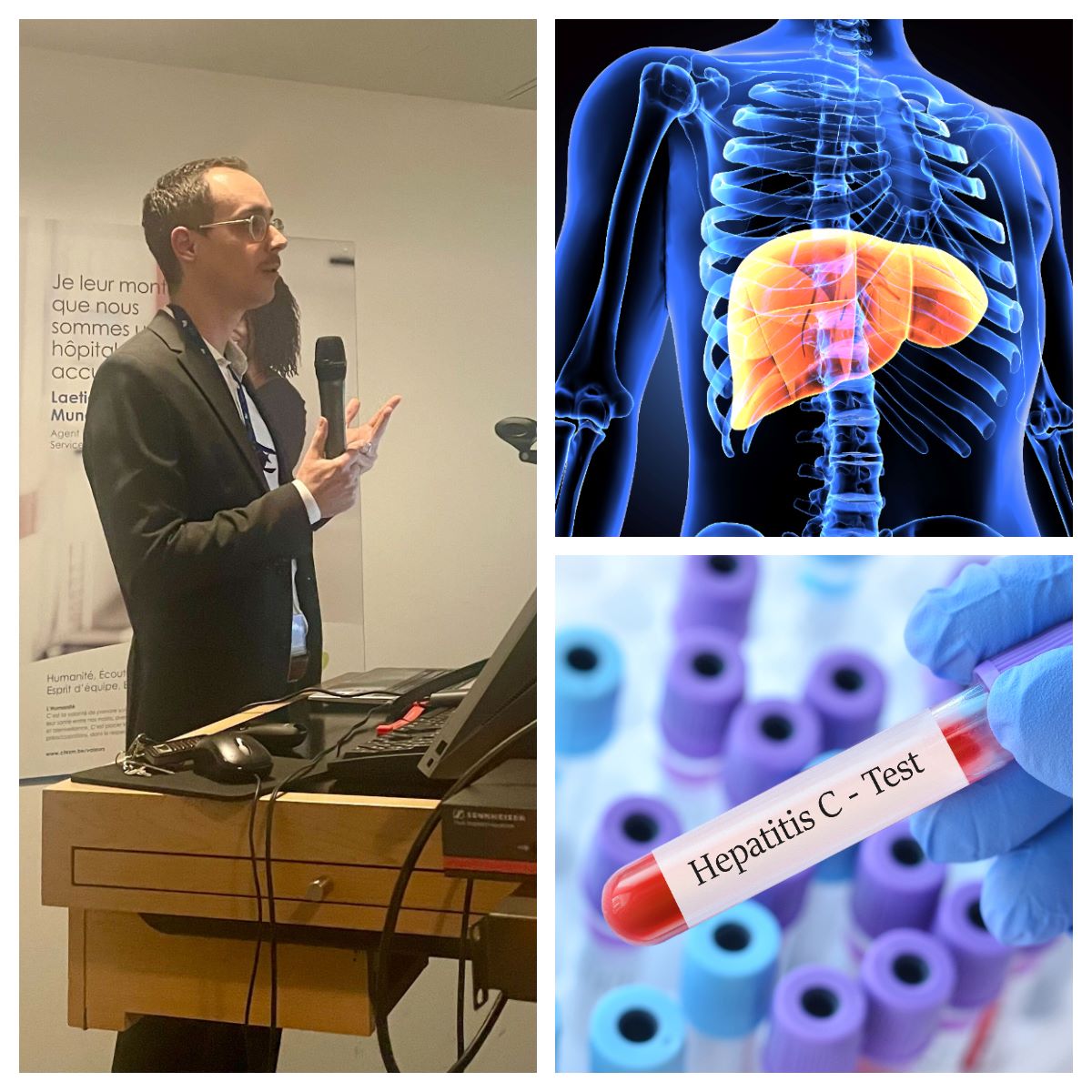 Hépatite C : un tueur silencieux qui peut mener au cancer du foie (Dr ...