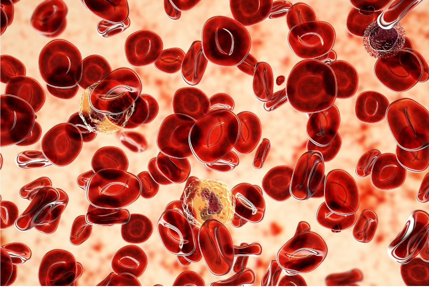 Polycythemia vera et thrombocytémie essentielle Que choisir entre ...