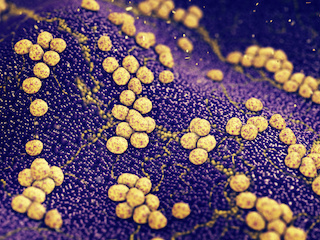 Prise en charge des infections sanguines à staphylocoque doré - MediQuality