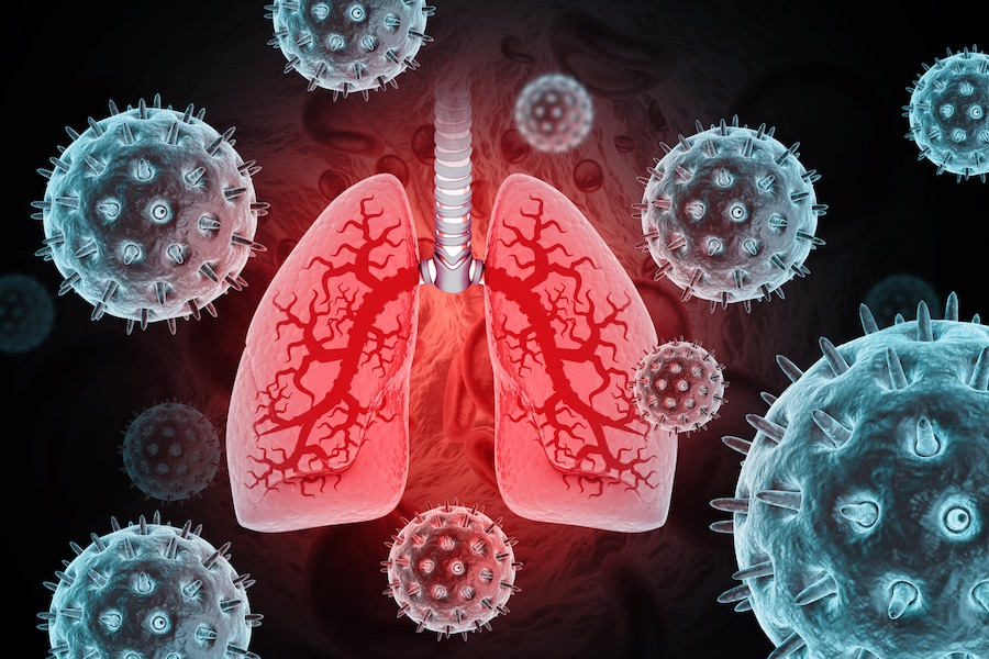 ‘Covid long’ : un phénomène observé dans d’autres infections ... ‘Covid long’ : un phénomène observé dans d’autres infections ...