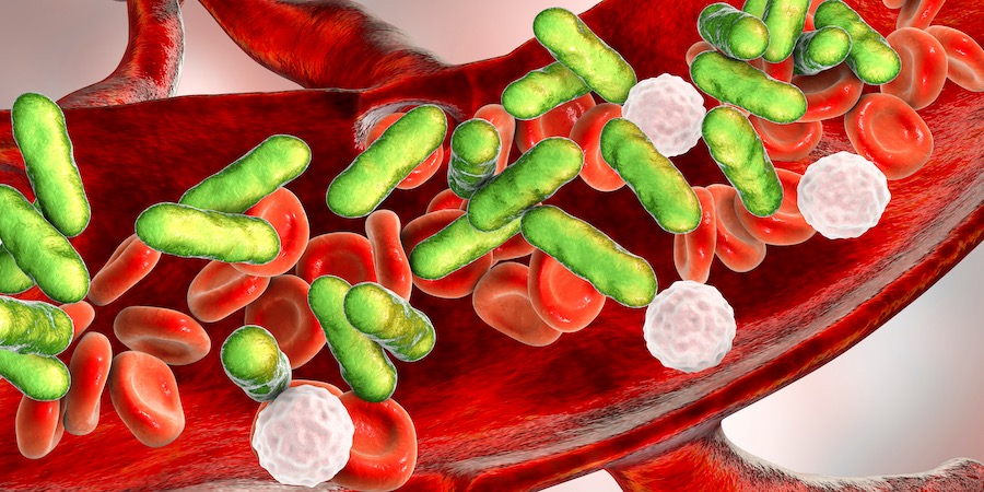 Sterk verband HLD-cholesterol en risico van sepsis - MediQuality