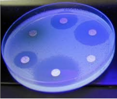 Infections sur biopsies prostatiques transrectales : demander un ...