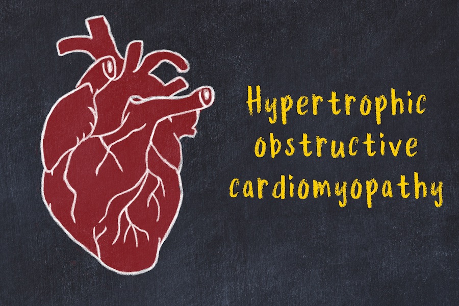 Hypertrofische obstructieve cardiomyopathie: helemaal niet zo zeldzaam ...