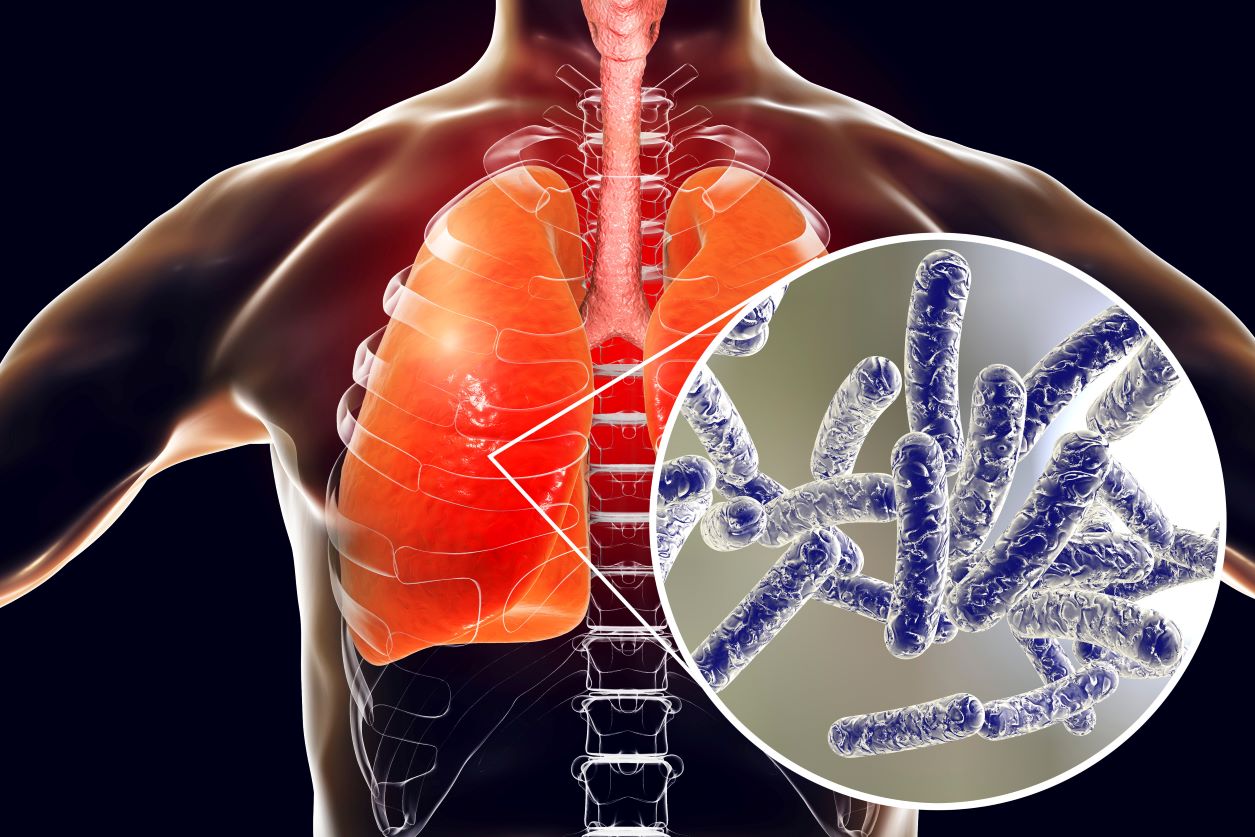 Contre la légionellose et le pneumocoque, le CHU de Liège innove ...
