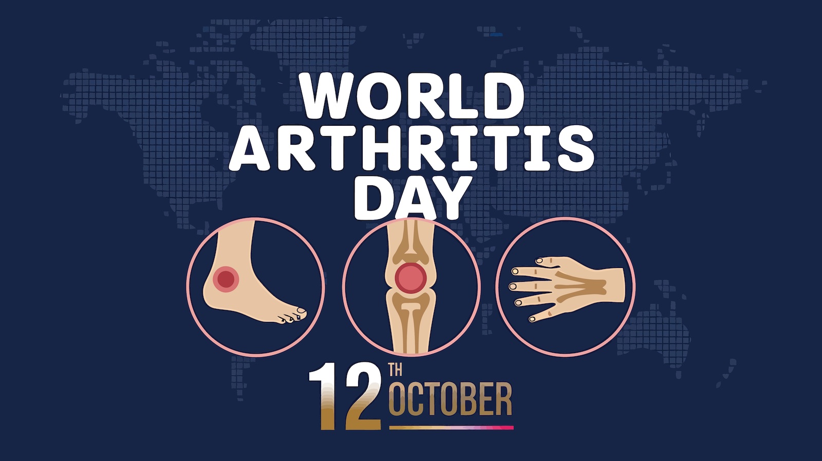 Rol van de voeding en voedingssupplementen bij de behandeling van artritis: RA, axSpA en ...