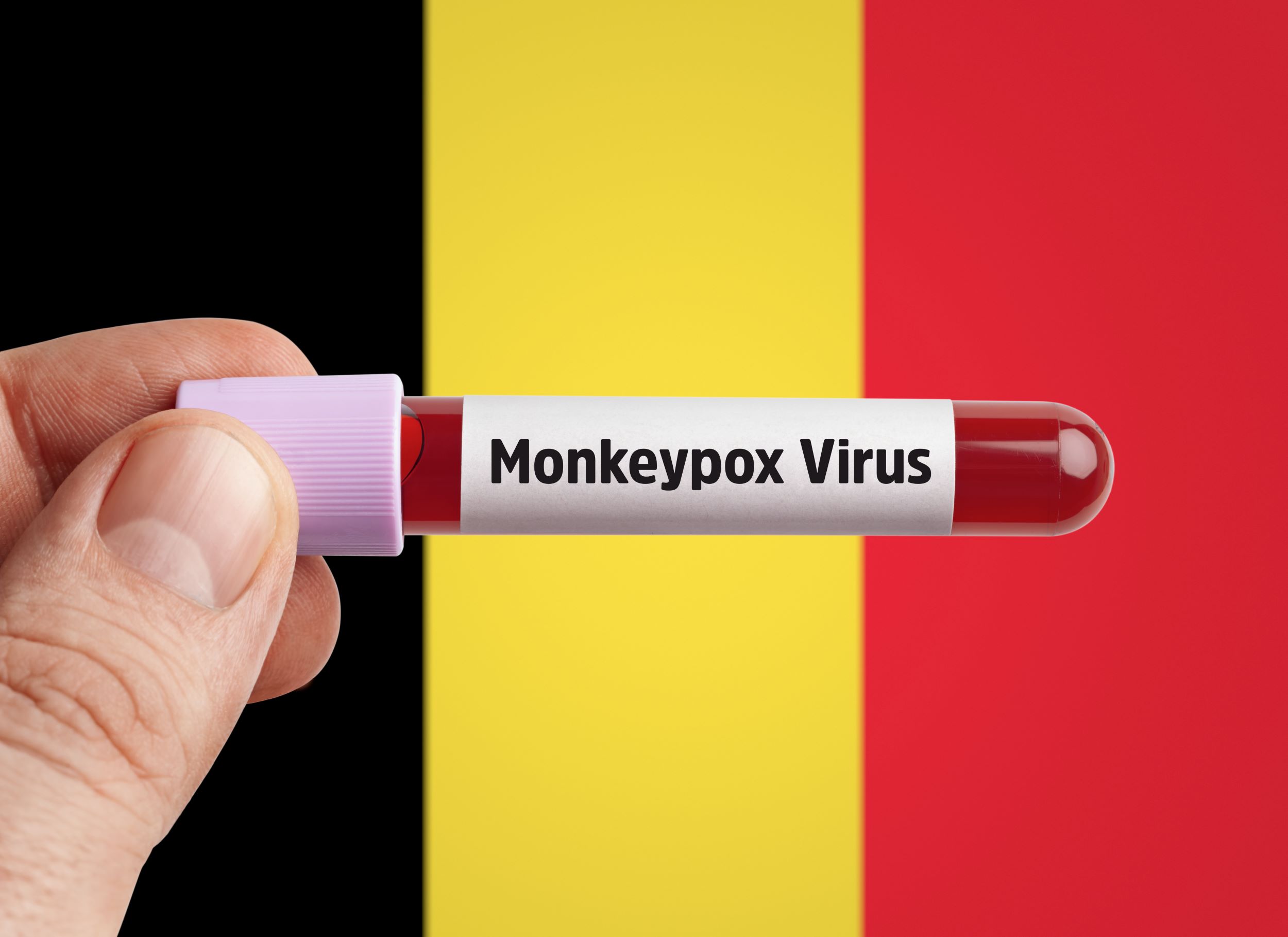 MPOX: volgens de Risk Management Group is de kans op besmetting in ...