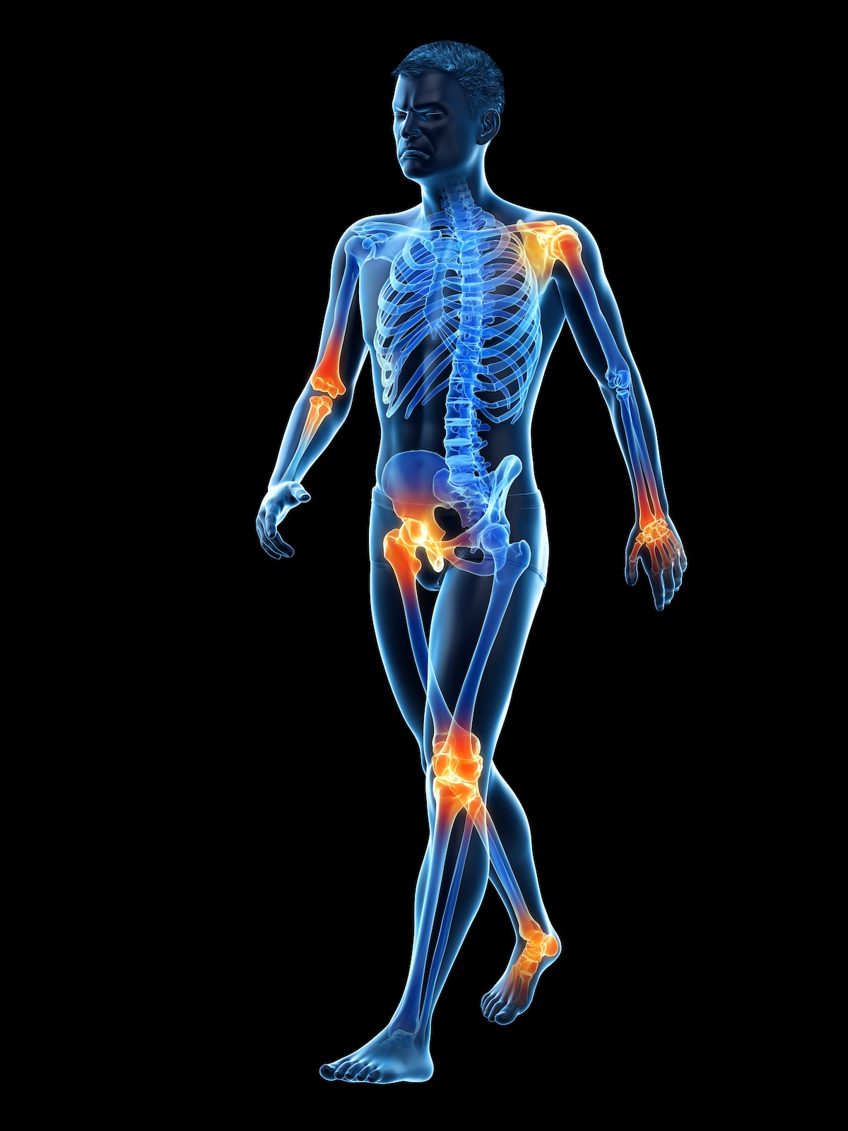 Wereld reuma dag - Half miljoen Belgen lijdt aan vorm van reuma ...